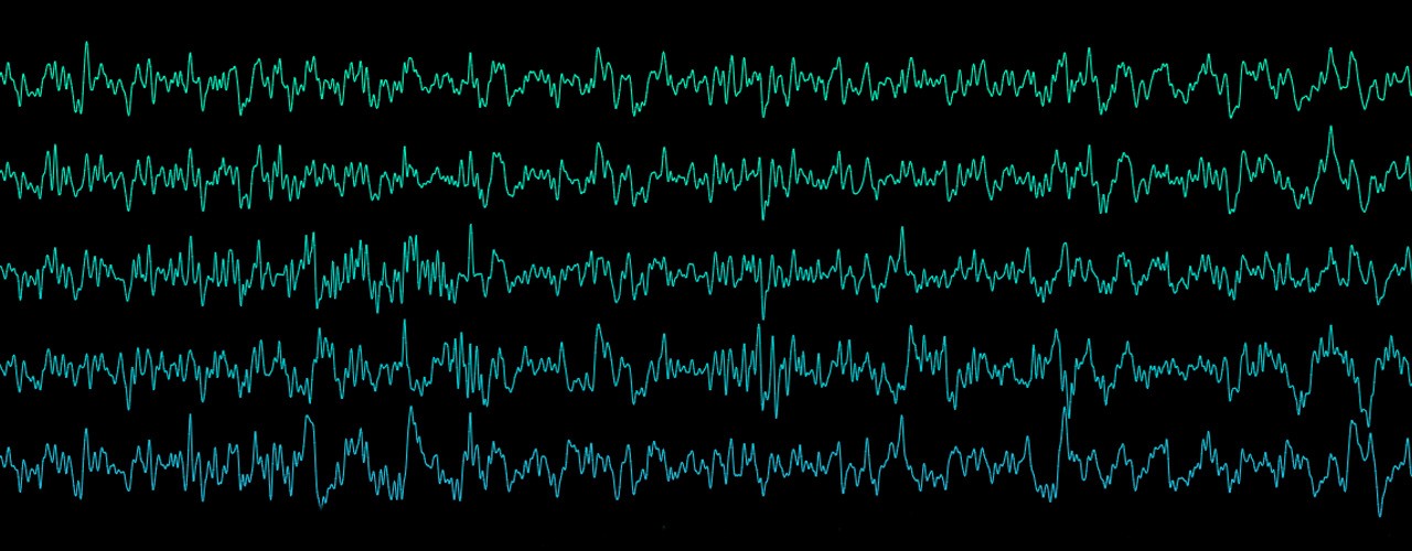 KBDGroup - Why we want to teach the world how to read brain waves
